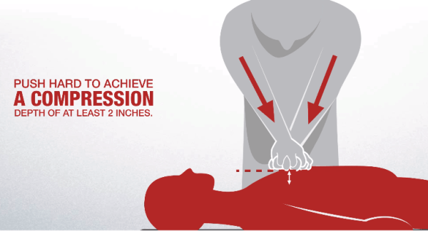 How to do CPR | First Aid BLS & Emergency Management Solutions
